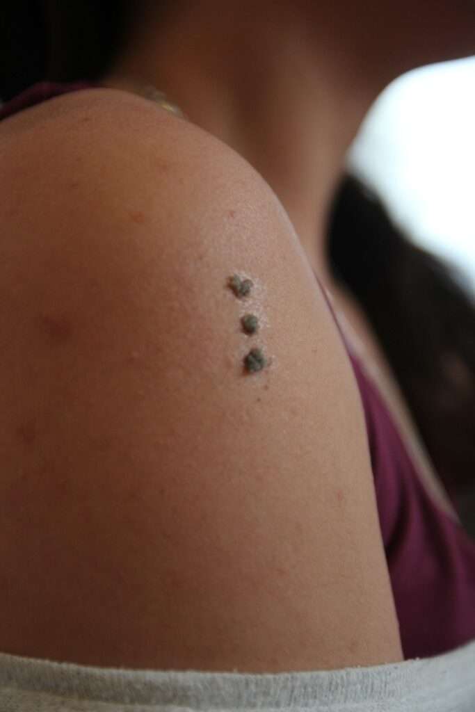 Kambo - Curandero.love